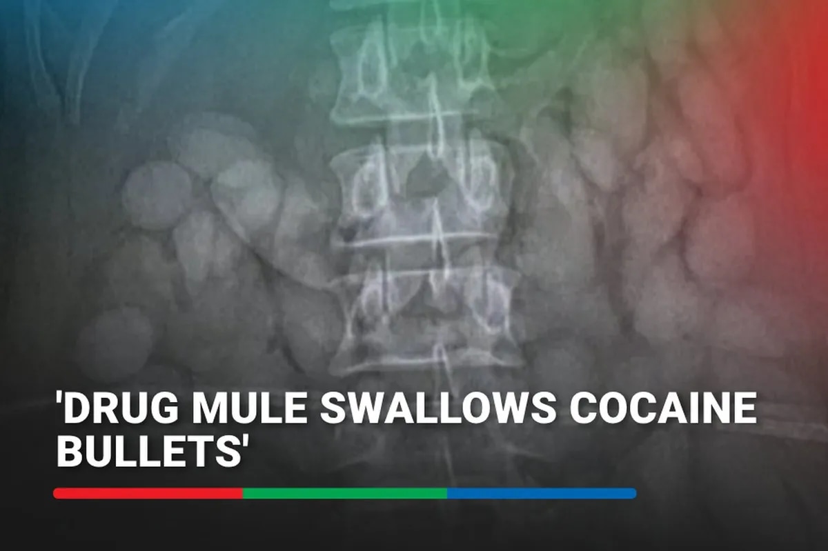 Woman caught with suspected cocaine bullets in stomach | ABS-CBN News
