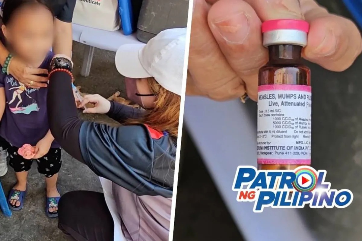 Tigdas, nakahahawa at nakamamatay: DOH | ABS-CBN News