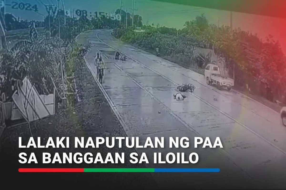 Lalaki naputulan ng paa sa banggaan sa Iloilo | ABS-CBN News Lalaki naputulan ng paa sa banggaan sa Iloilo | ABS-CBN News