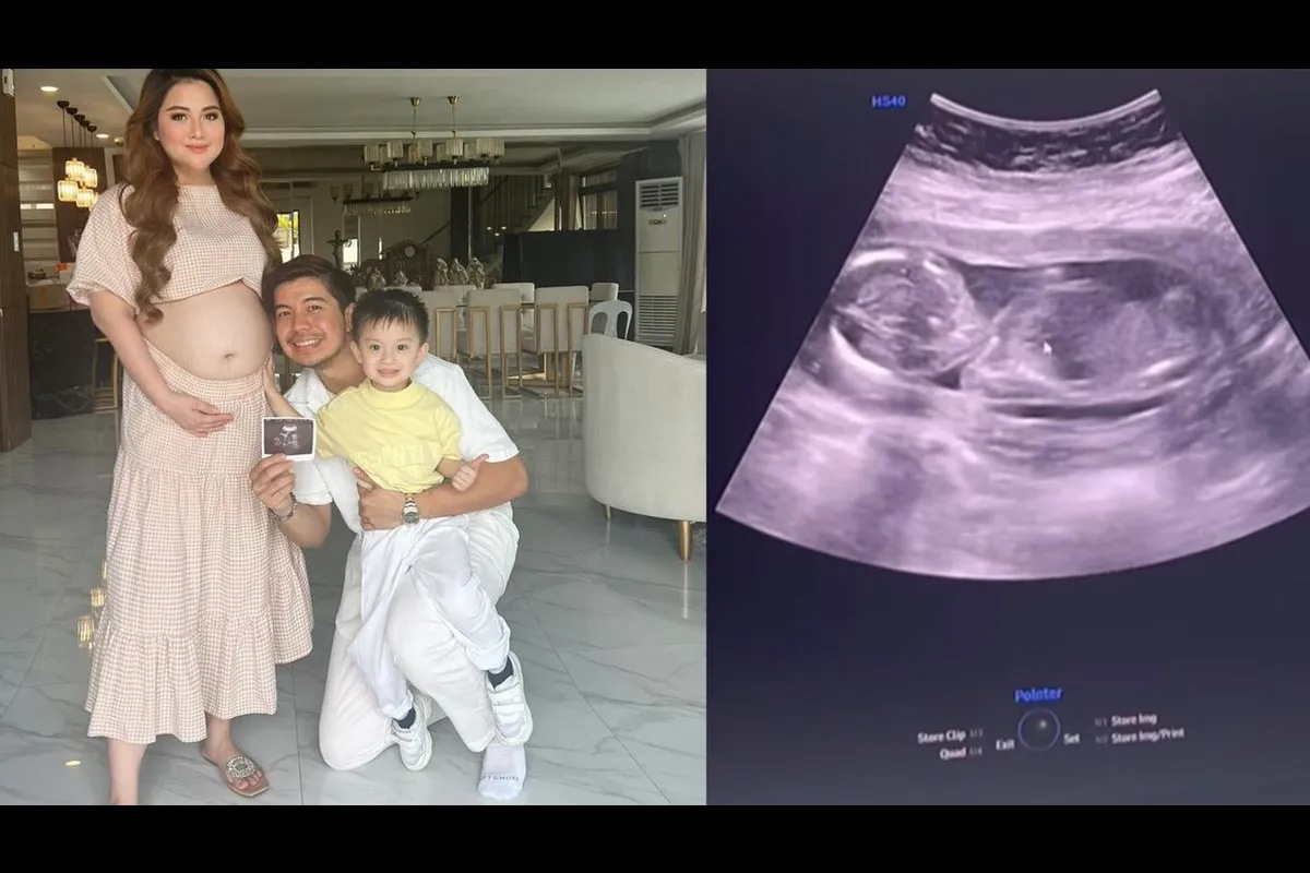 Dianne Medina, Rodjun Cruz expecting second child | ABS-CBN Entertainment