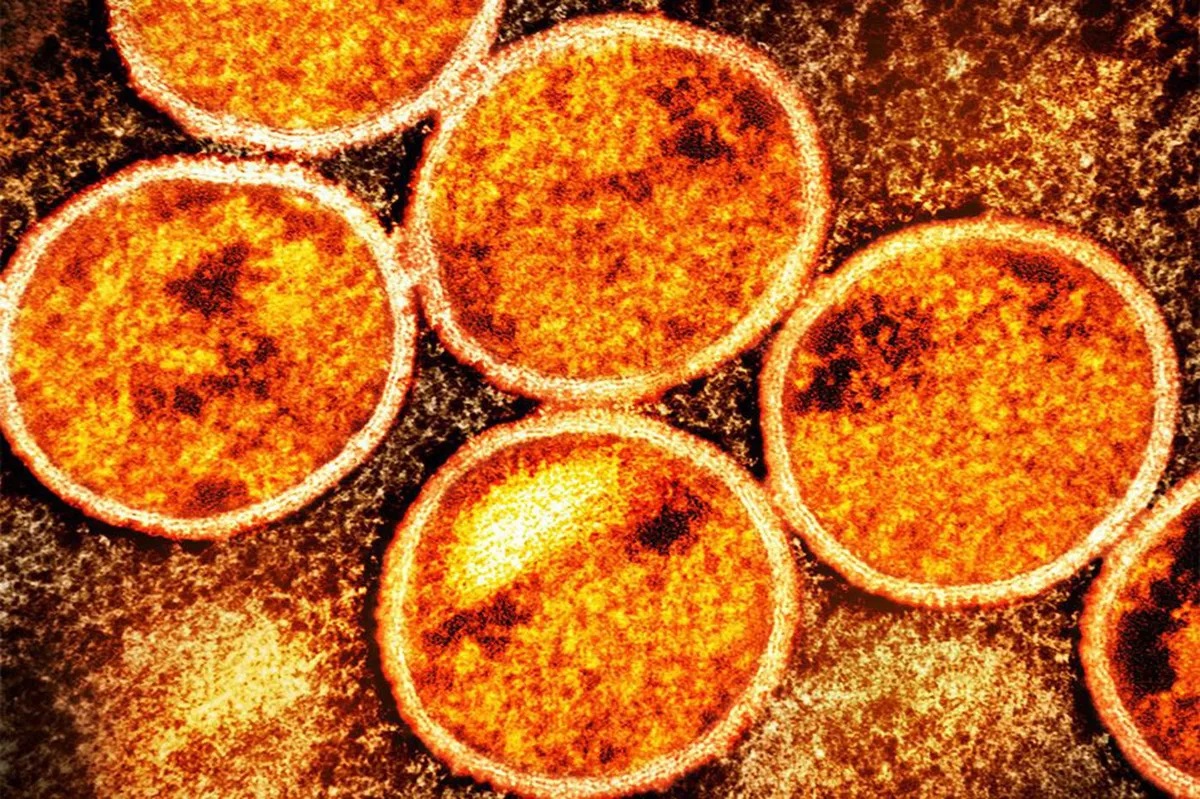 Is there a way to detect mpox early? | ABS-CBN Metro.Style