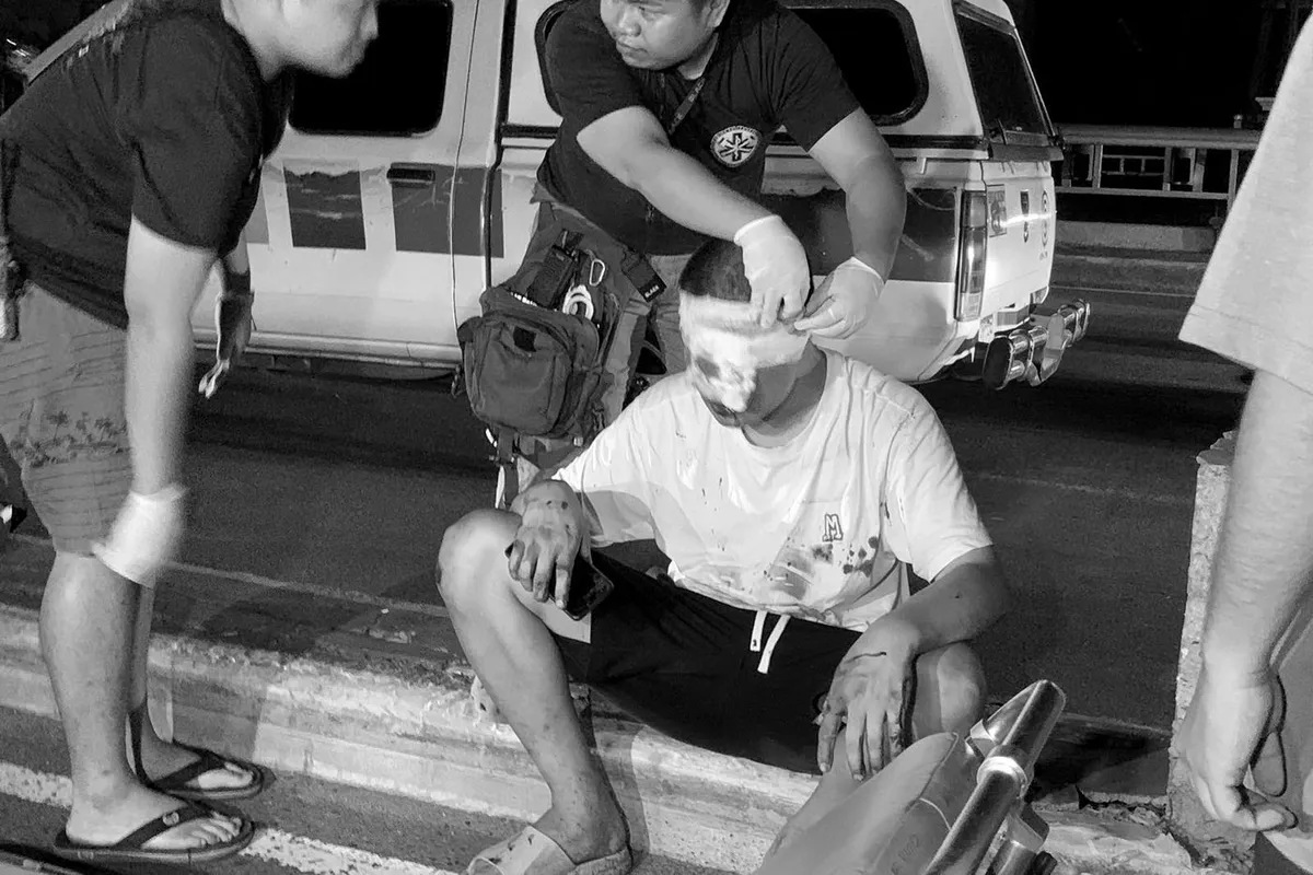 Lalaki sugatan matapos sumalpok ang minamanehong e-bike sa truck sa ... Lalaki sugatan matapos sumalpok ang minamanehong e-bike sa truck sa ...