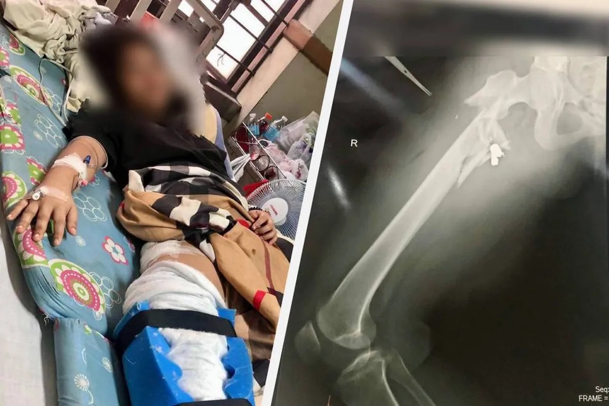 Pulis aksidenteng nakabaril ng 18-anyos na dalaga | ABS-CBN News Pulis aksidenteng nakabaril ng 18-anyos na dalaga | ABS-CBN News
