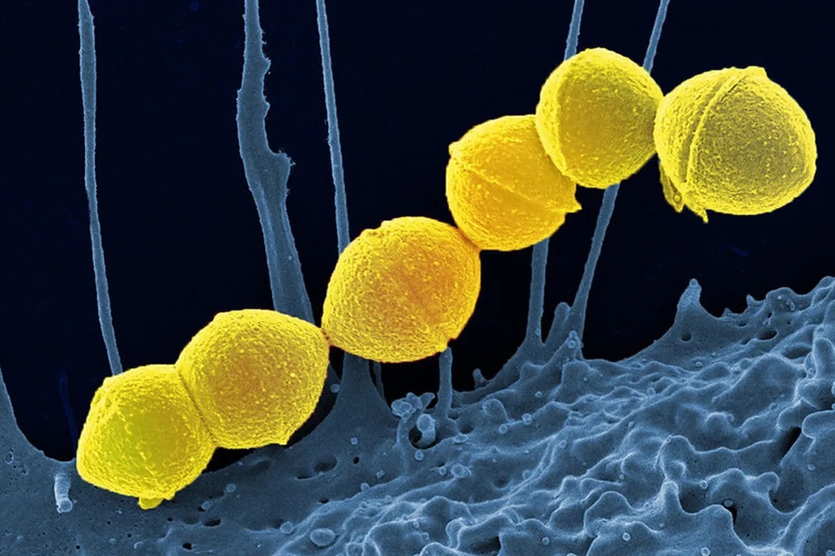 'Flesh-eating' bacterium cases hit record high in Japan | ABS-CBN News