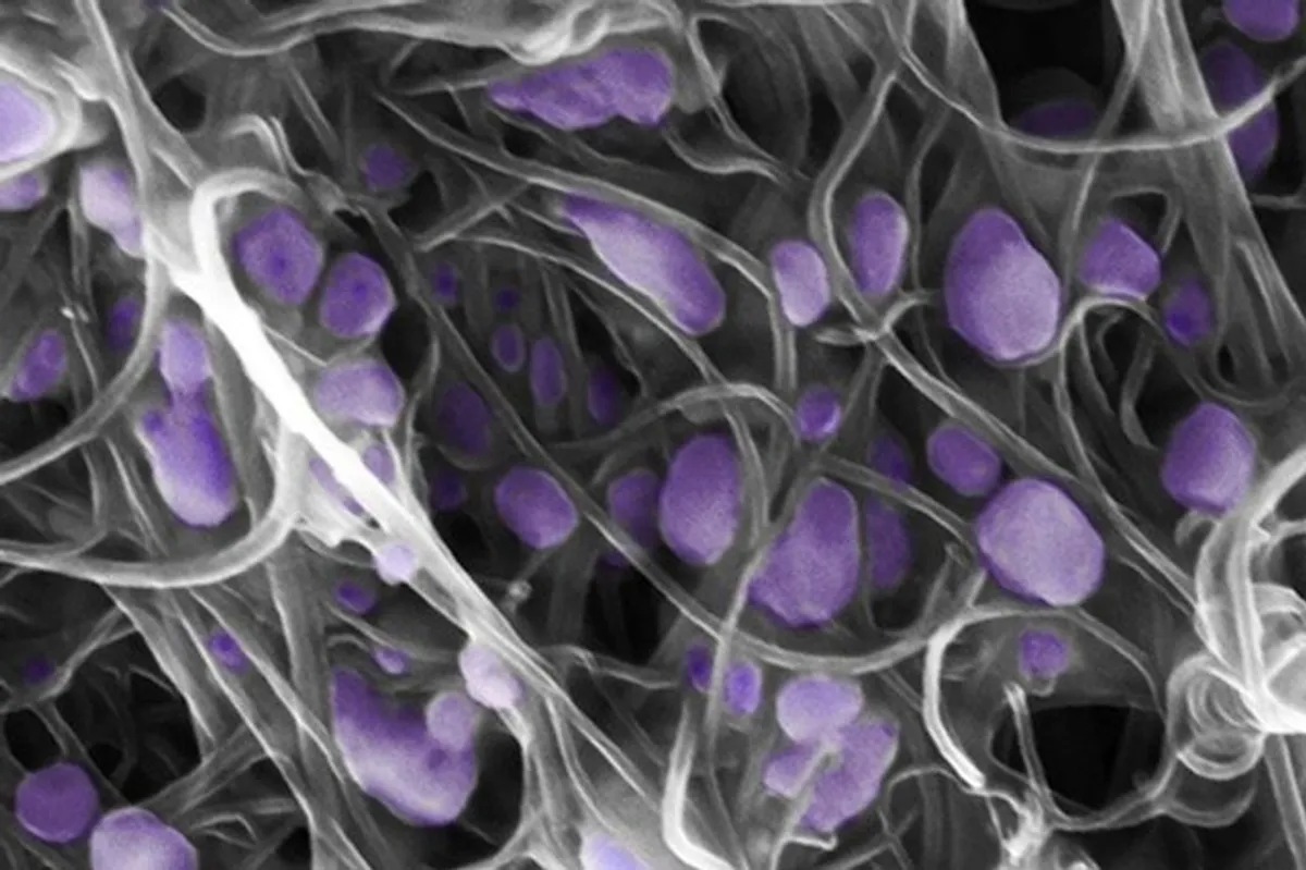 First human case of H5N2 died from multiple factors: WHO | ABS-CBN ...