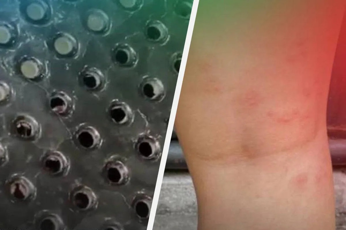 Surot sa NAIA, paano susugpuin? | ABS-CBN News