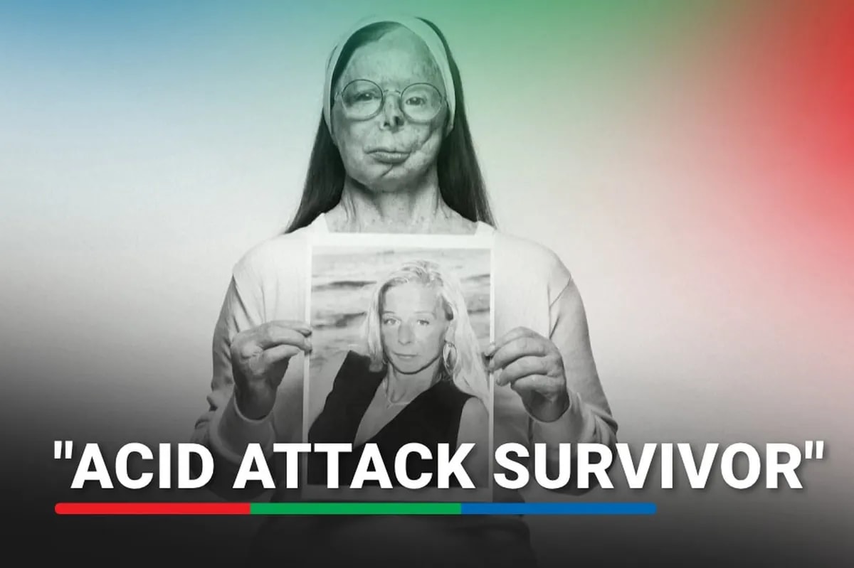 Acid attack survivor fronts fashion book in new awareness campaign ...