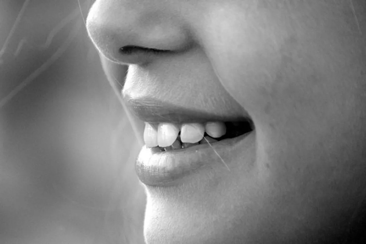 1 in every 2 Filipinos experienced 'smile shame': survey | ABS-CBN ...