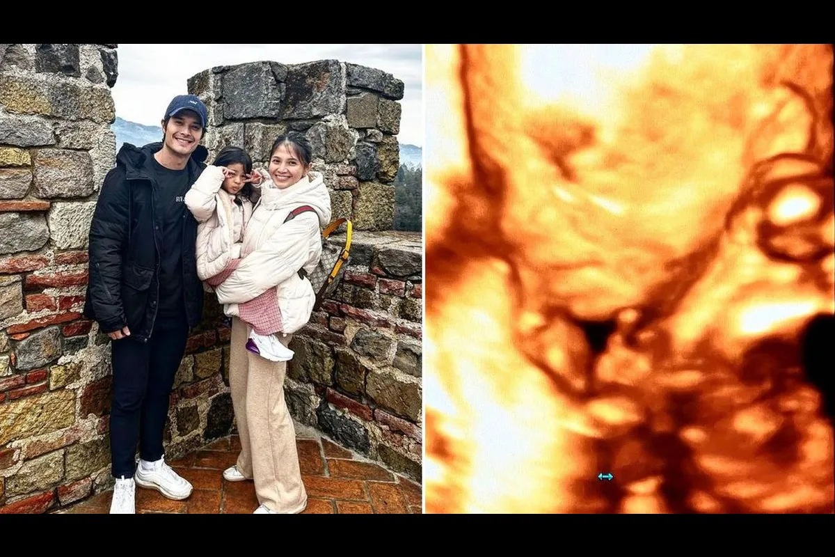 JC de Vera shares sonogram of second baby | ABS-CBN Entertainment
