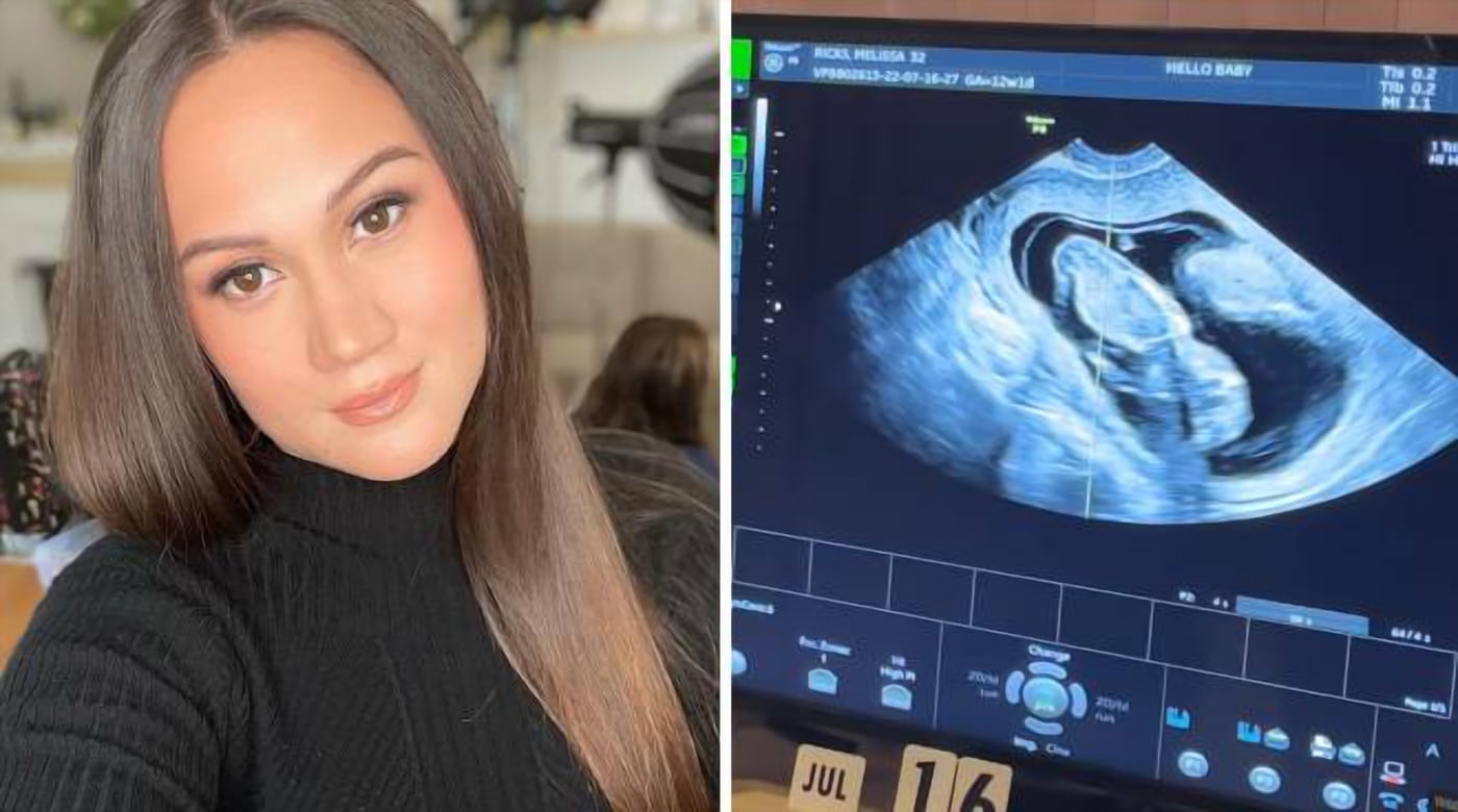 Melissa Ricks is pregnant with second child | ABS-CBN Entertainment