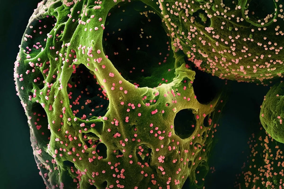 Philippines detects 3 more cases of omicron subvariant Arcturus; total ...