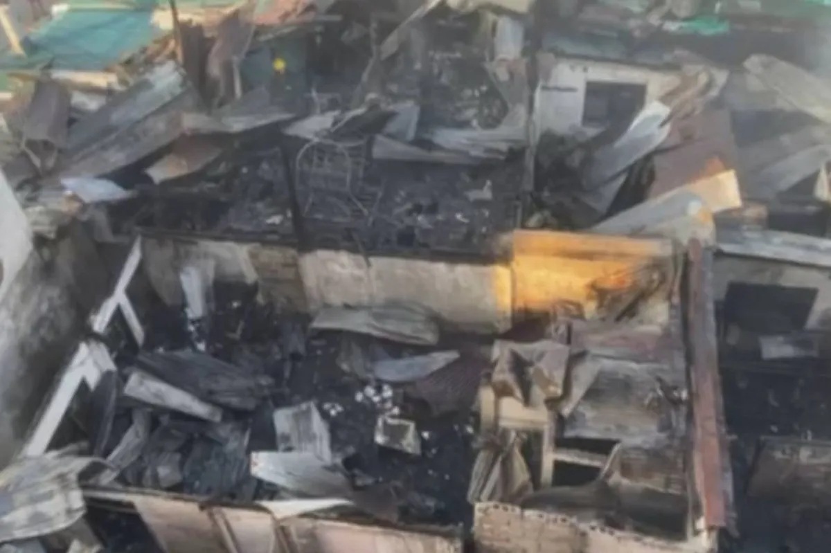 Bata nagtamo ng mga paso sa sunog sa Makati | ABS-CBN News