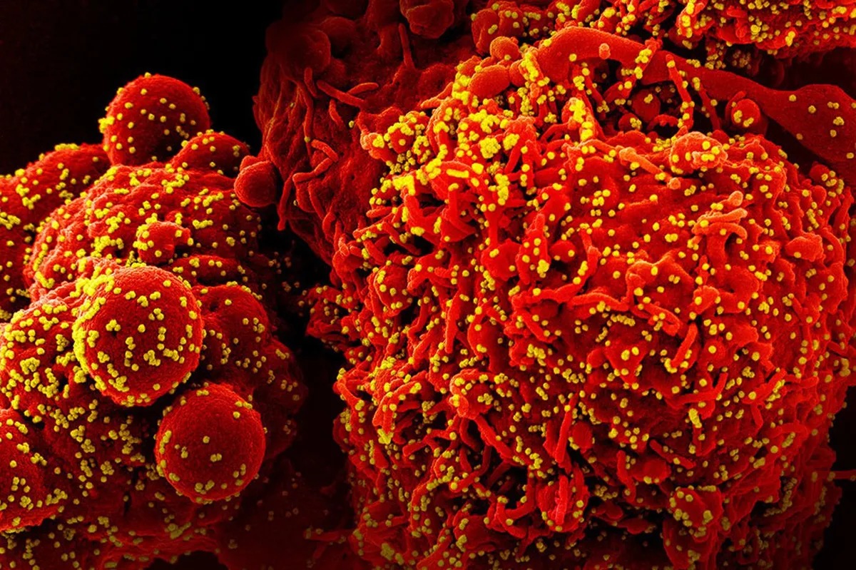 Philippines records first cases of COVID variants XBB.1.5, CH.1.1 | ABS ...