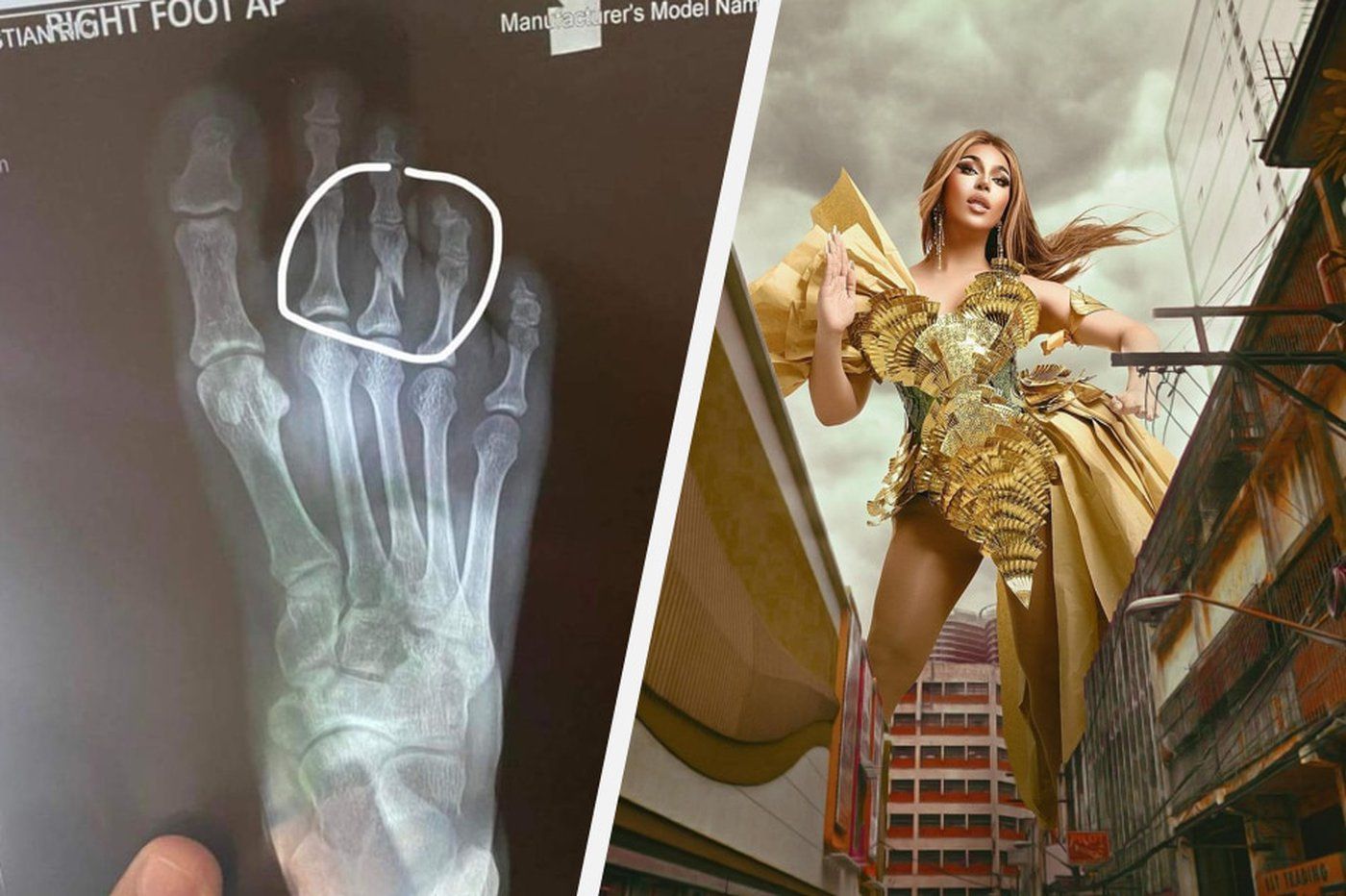 Viñas Deluxe confirms injury from 'Drag Race PH' challenge | ABS-CBN ...