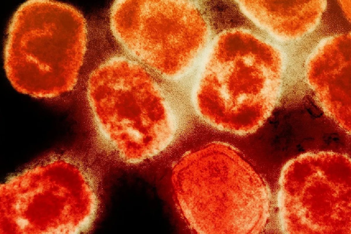 Fourth monkeypox case detected in Philippines | ABS-CBN News