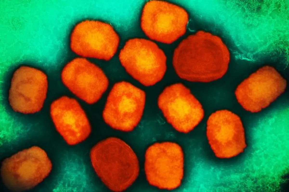 DOH rejects lockdown due to monkeypox cases | ABS-CBN News