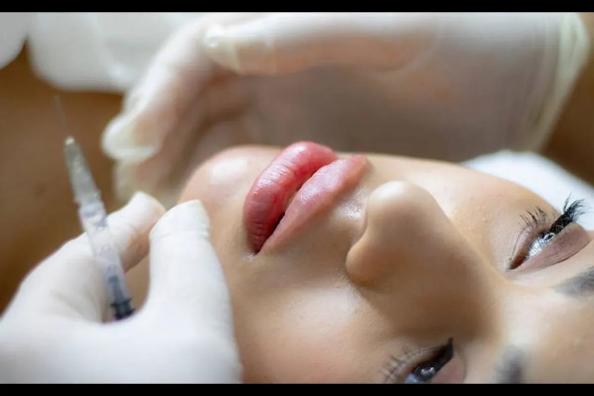 7 Things You Should Know Before Getting Fillers | ABS-CBN Lifestyle