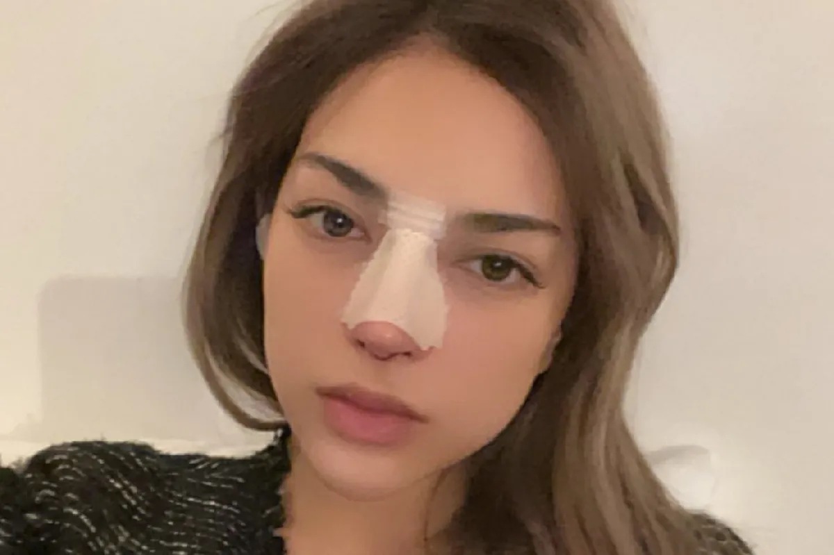 'Officially retokada': Vlogger gets real about nose job | ABS-CBN Lifestyle