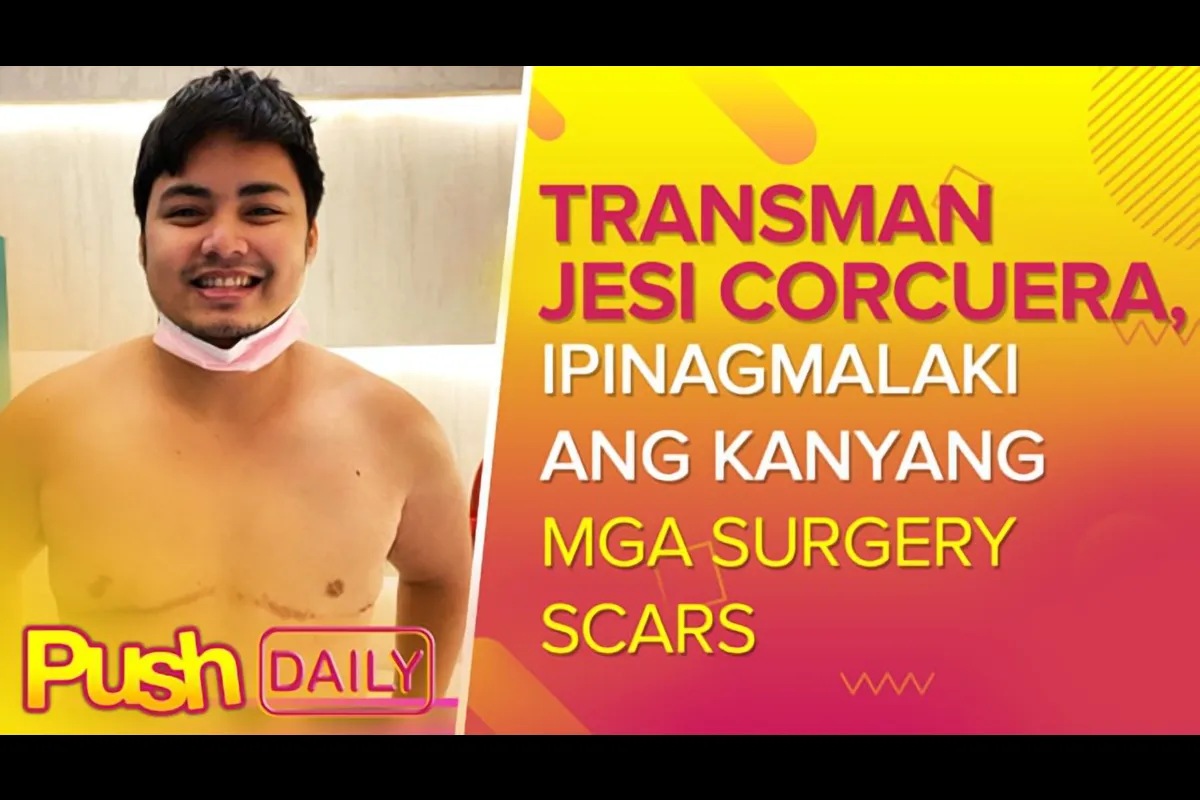 Transman Jesi Corcuera, ipinagmalaki ang kanyang mga surgery scars ...