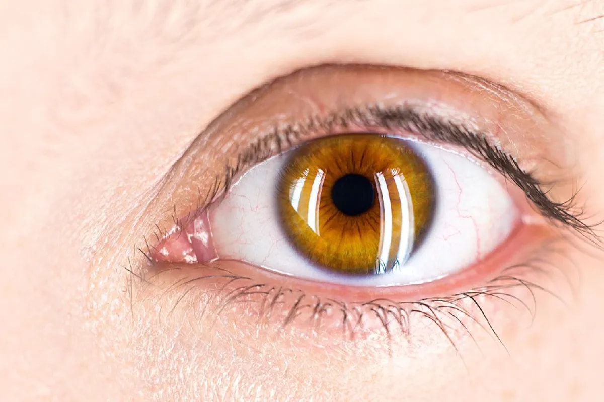 HK scientist develops retinal scan technology to identify early ...