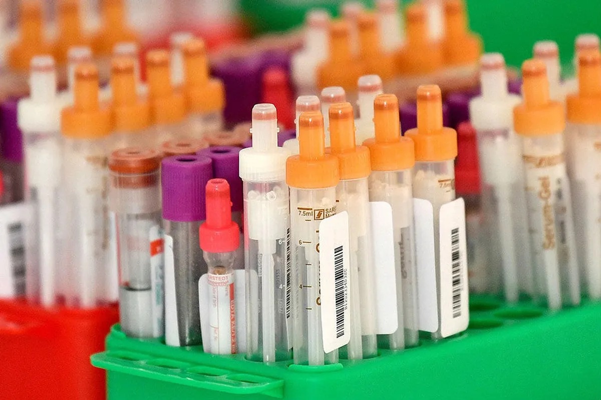 COVID-19 SCIENCE: In-home antibody test shows promise | ABS-CBN