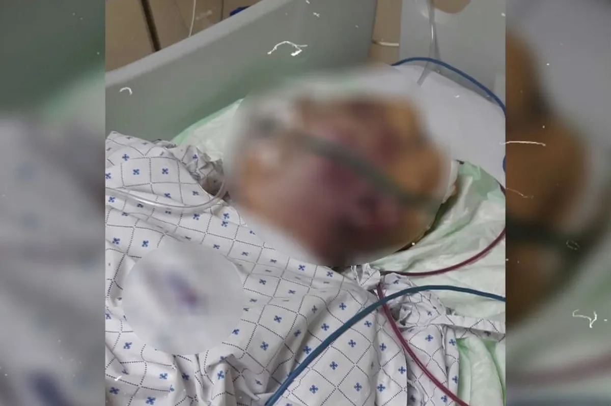 SOCO: Babae basag ang bungo matapos hampasin sa ulo ng live-in partner ...