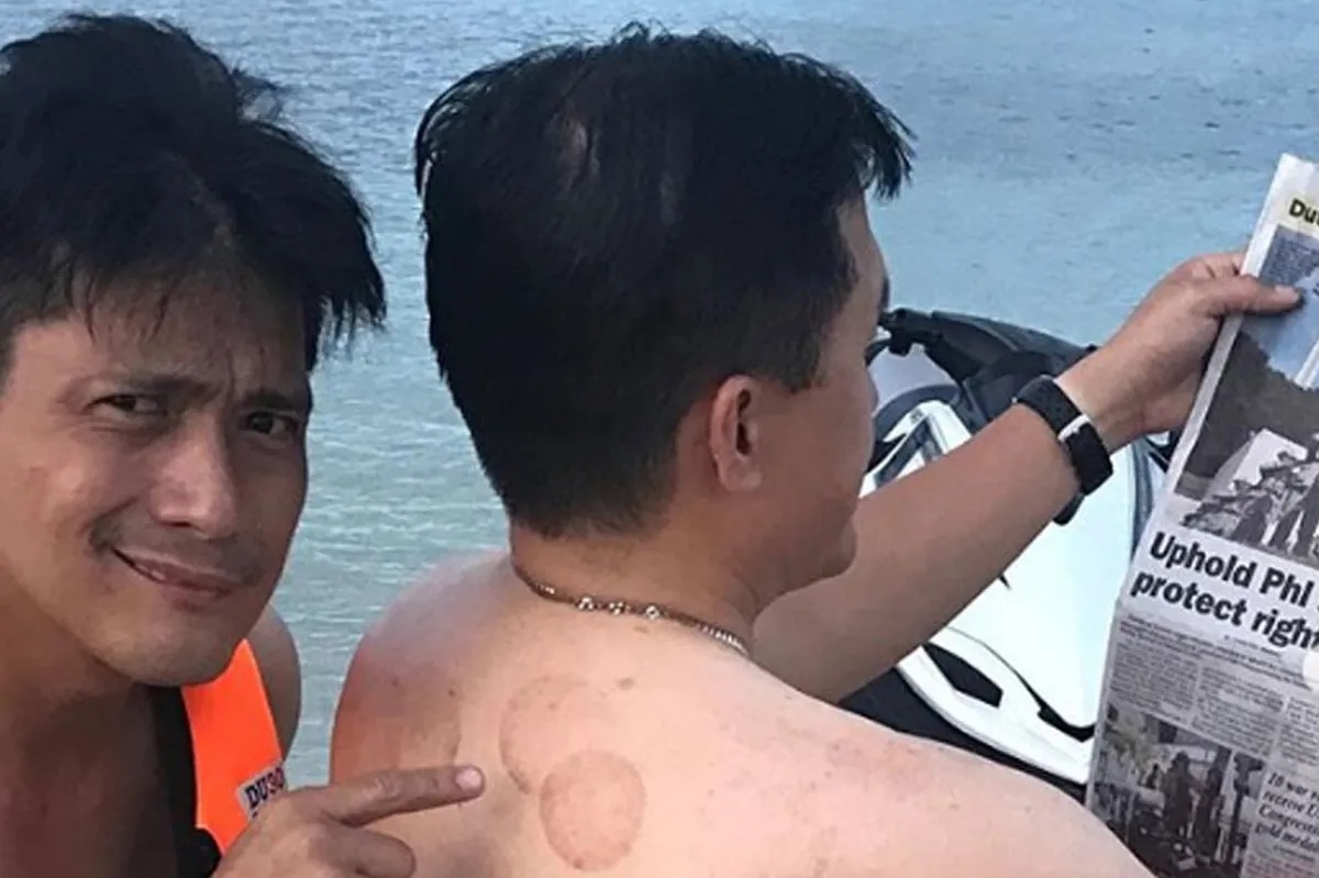 'Hindi po tattoo kundi bentosa': Robin Padilla explains marks on Bong ...