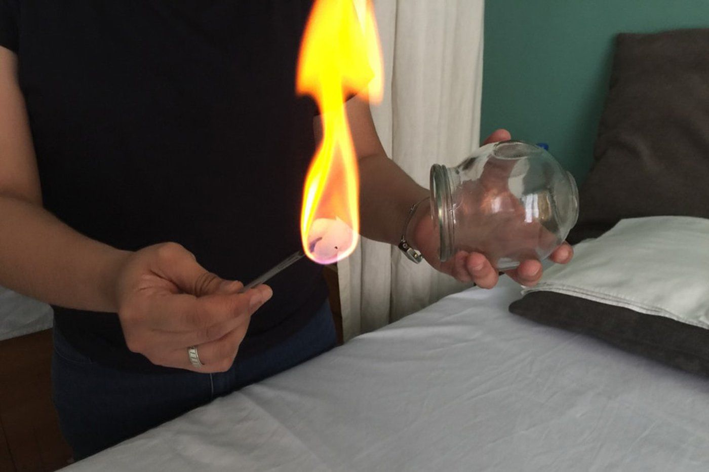 Fire and glass: What is ventosa or cupping therapy? | ABS-CBN Lifestyle