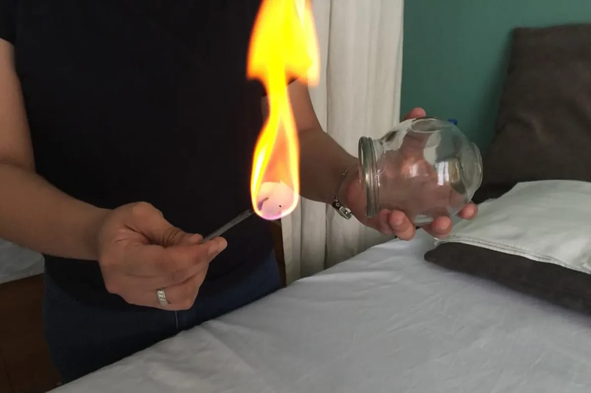 Fire and glass: What is ventosa or cupping therapy? | ABS-CBN Lifestyle