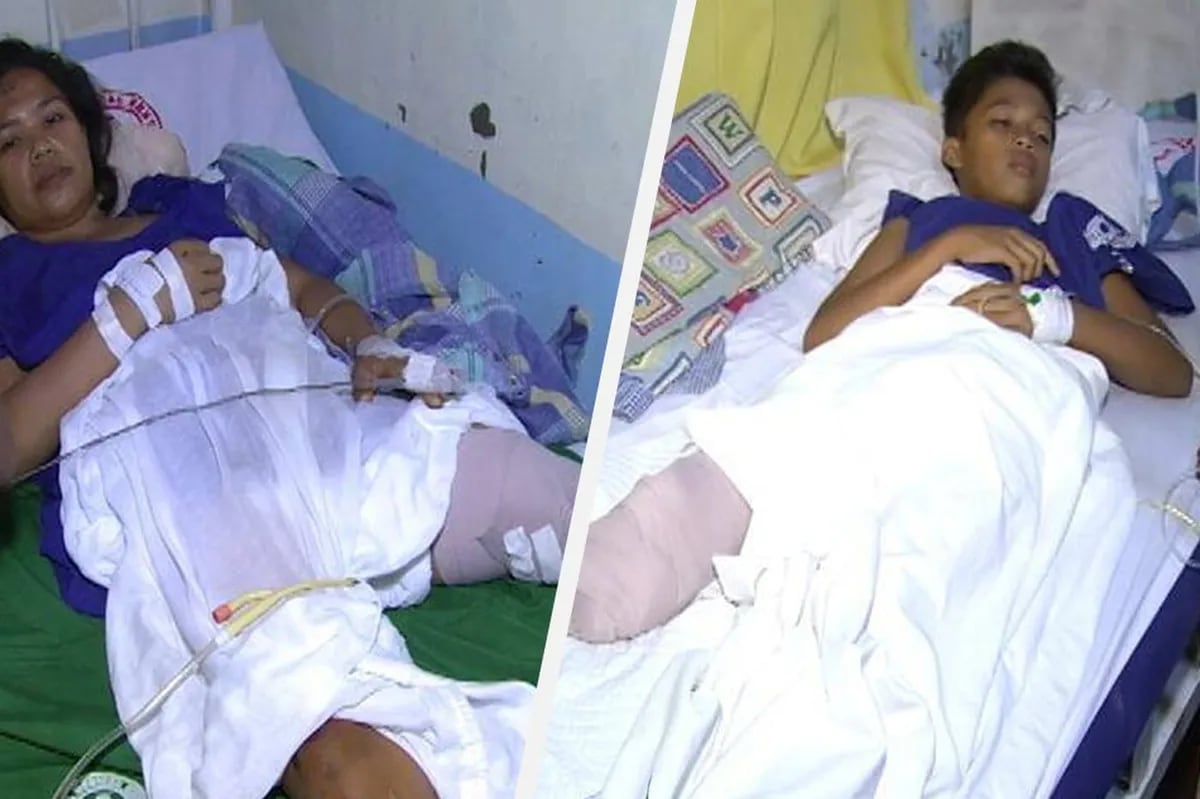 Mag-ina, naputulan ng paa nang salpukin ng kotse | ABS-CBN News Mag-ina, naputulan ng paa nang salpukin ng kotse | ABS-CBN News