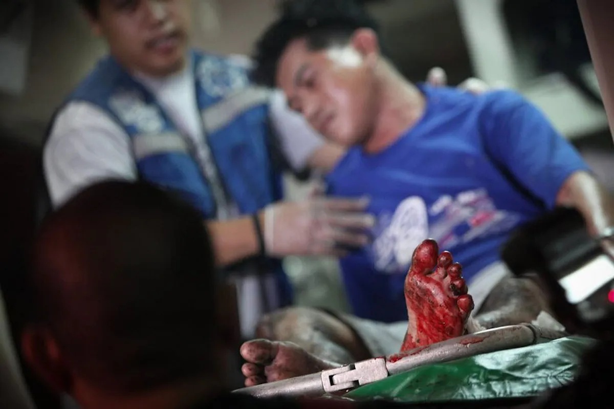 Firecracker-related injuries climb to 24 a day after Christmas: DOH ...