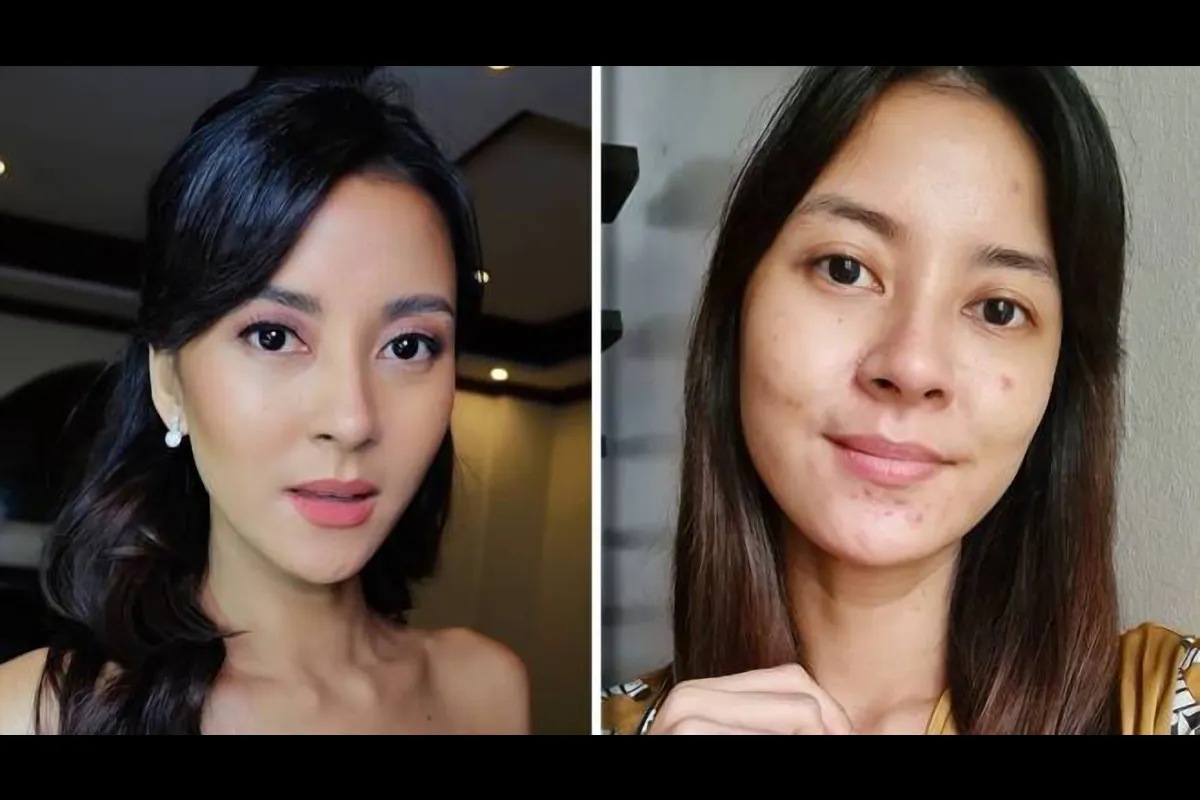 Bianca Gonzalez-Intal posts ‘no filter’ pic and gets candid about skin ...