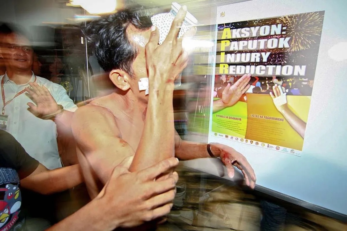 Bilang ng sugatan sa paputok, umakyat sa 86 sa bisperas ng bagong taon | ABS-CBN News