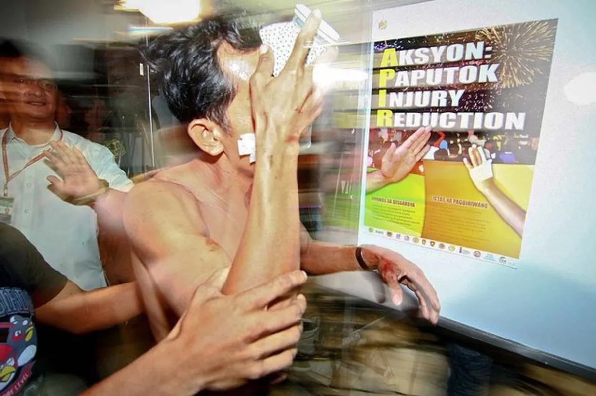 Bilang ng sugatan sa paputok, umakyat sa 86 sa bisperas ng bagong taon ...