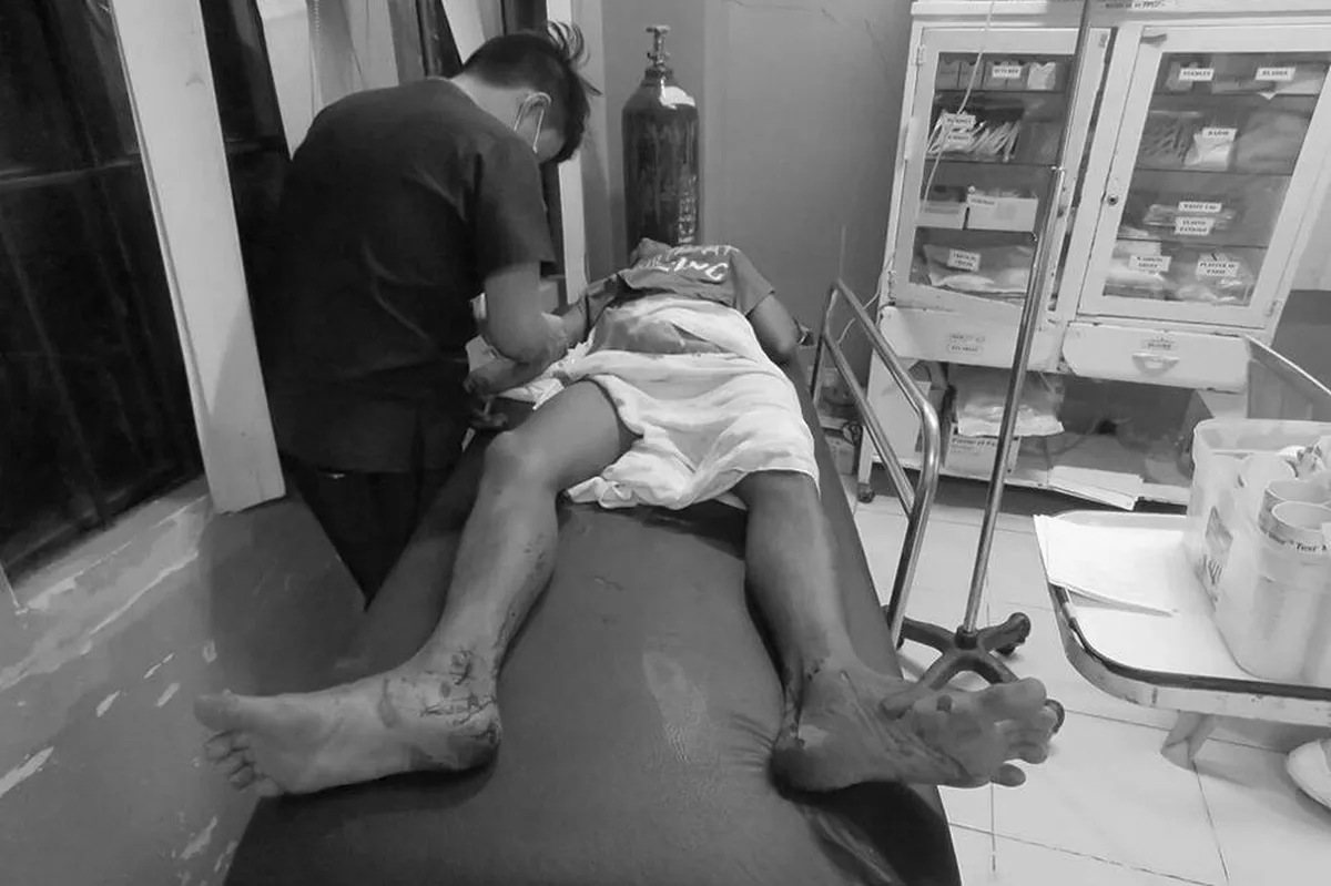 Lalaki sinaksak ng kapatid dahil sa biro sa sugal | ABS-CBN News Lalaki sinaksak ng kapatid dahil sa biro sa sugal | ABS-CBN News