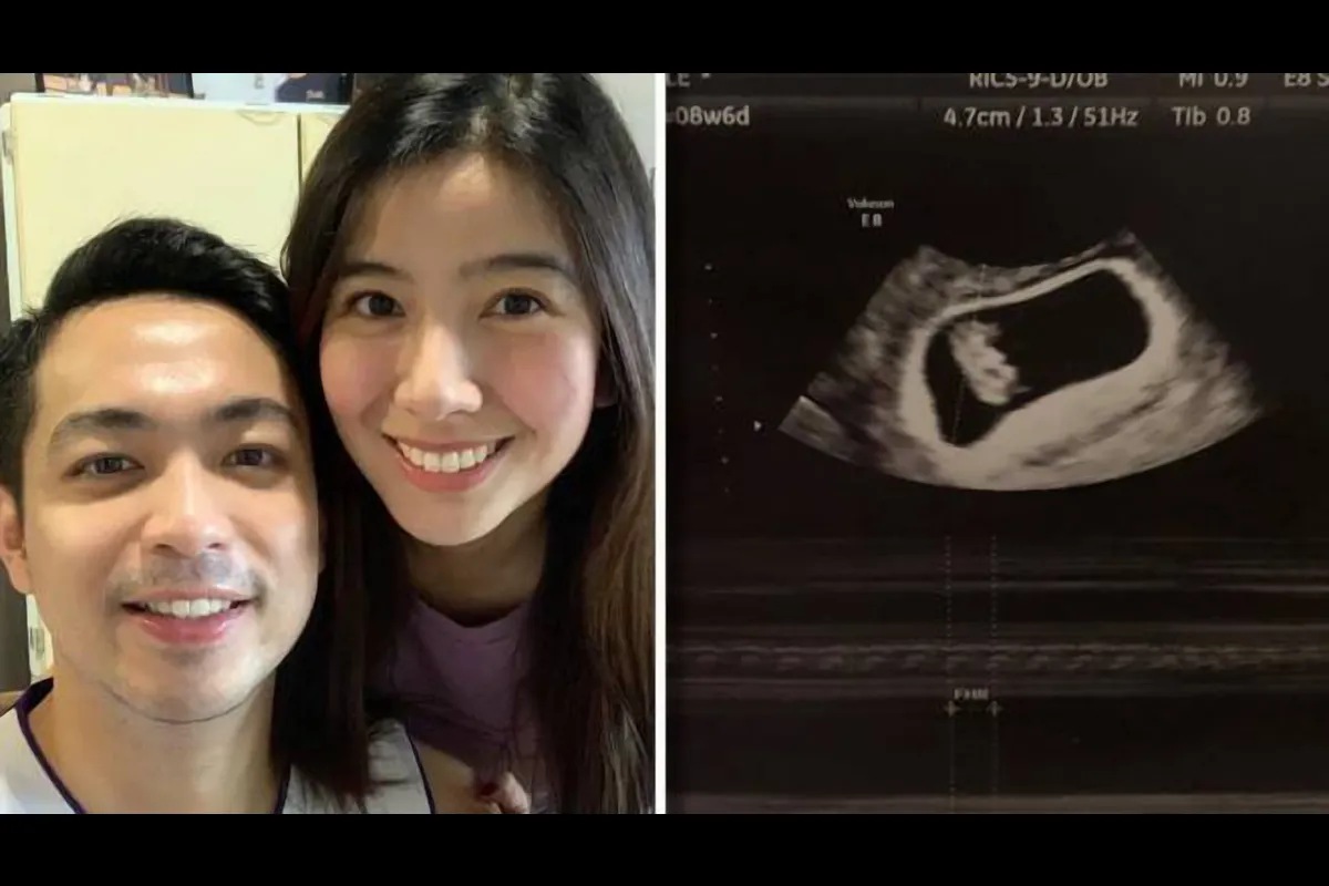 ABS-CBN Sportscaster Migs Bustos, wife expecting first baby | ABS-CBN ...