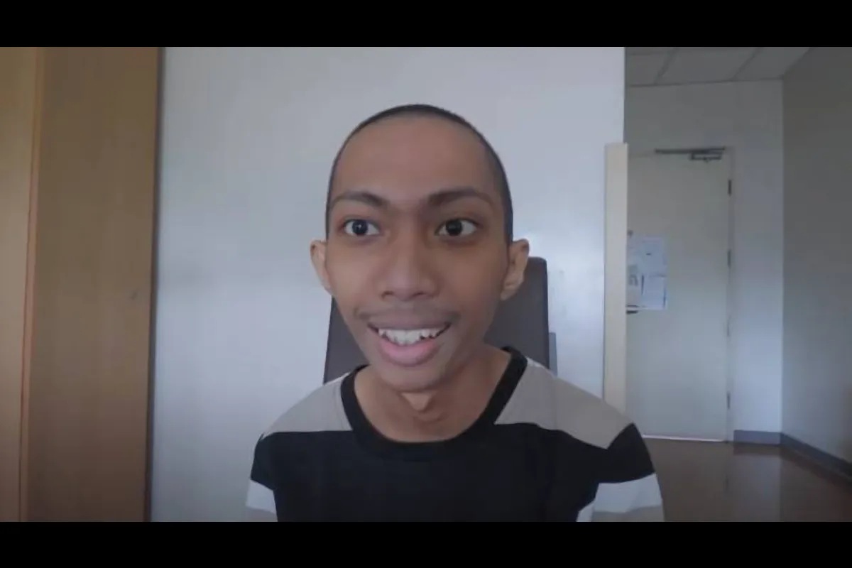 WATCH: Vlogger Emman Nimedez undergoes chemotherapy | ABS-CBN Entertainment