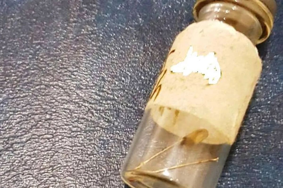 Paslit nakalunok ng perdible | ABS-CBN News