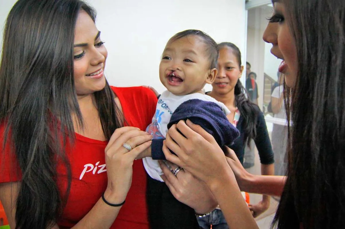 Kailan dapat pa-operahan ang bingot? | ABS-CBN Lifestyle