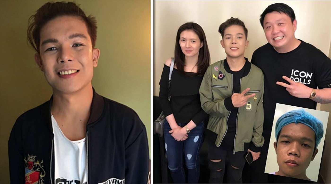 Cost of Marlou Arizala's total transformation revealed! | ABS-CBN Entertainment