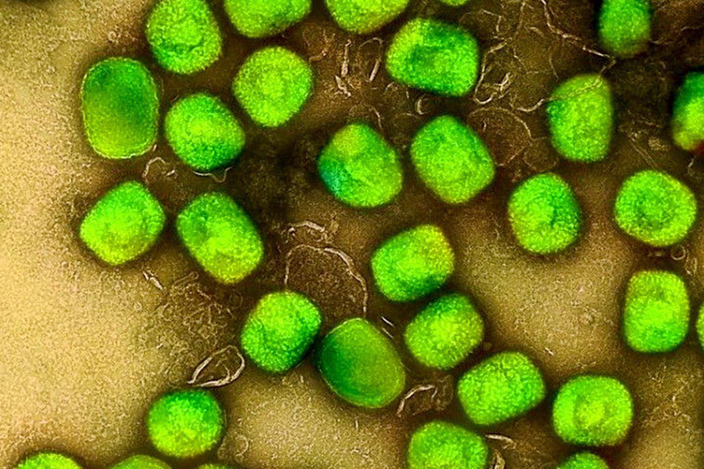 QC logs 6th mpox case; orders closure of club at address of previously ...