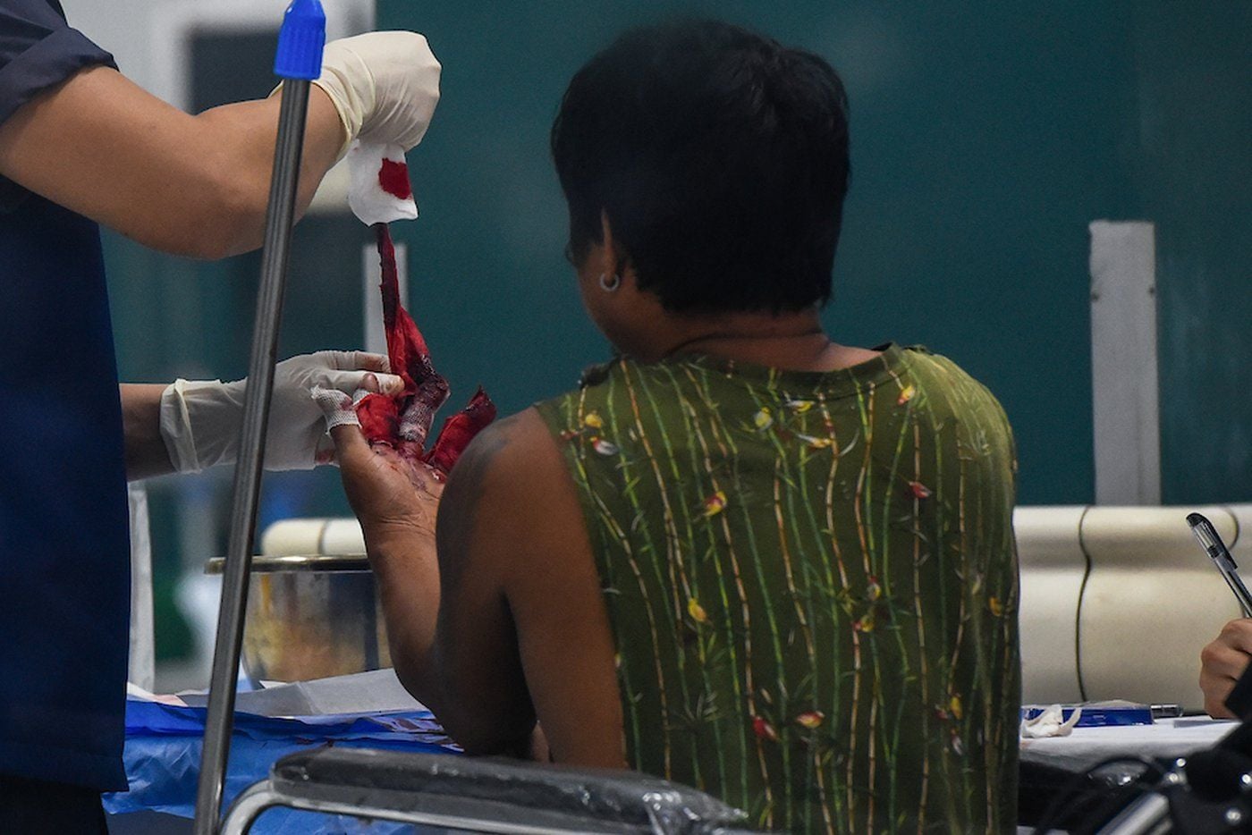 DOH reports 17 firecracker-related injuries in just two days | ABS-CBN News