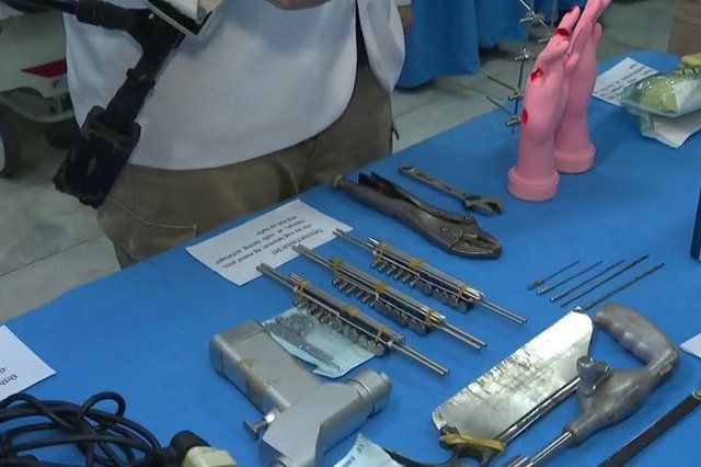DOH: Biktima ng paputok pinakamarami sa Metro Manila | ABS-CBN News