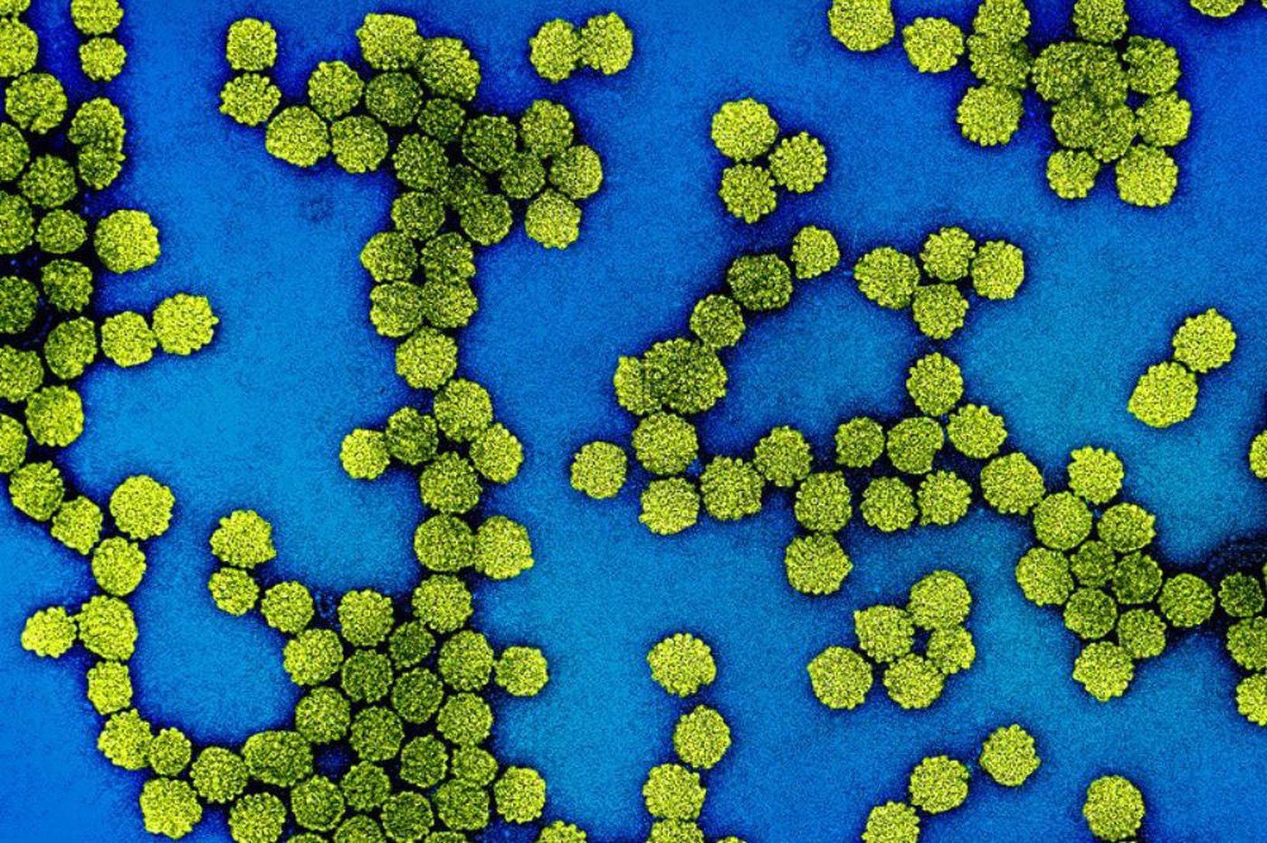 Herbosa: DOH to begin free HPV immunization for Filipino girls | ABS ...