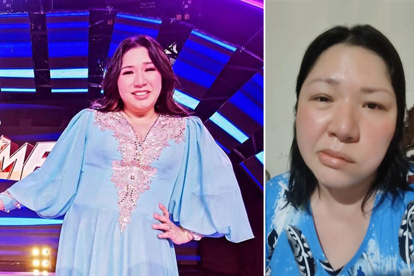 Frenchie Dy suffers third Bell’s Palsy attack: ‘Laban lang’ | ABS-CBN ...