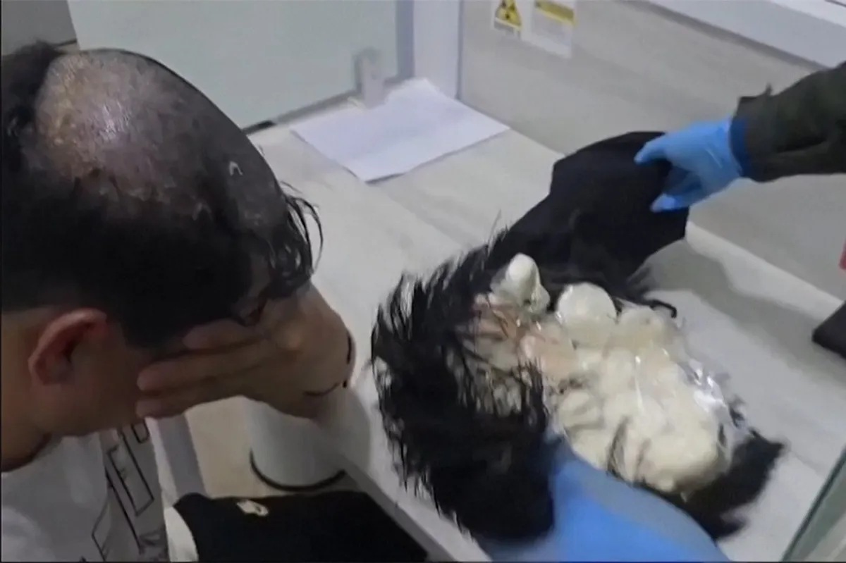Man tries to smuggle drugs under toupee in Colombia | ABS-CBN News