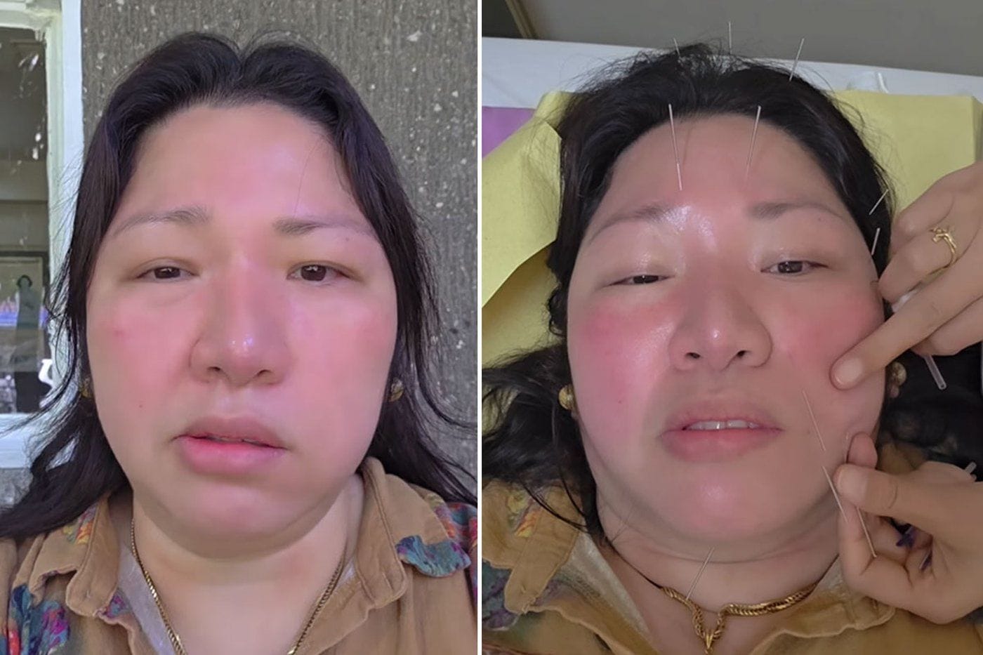 Frenchie Dy shares learnings from her third battle with Bell’s Palsy ...
