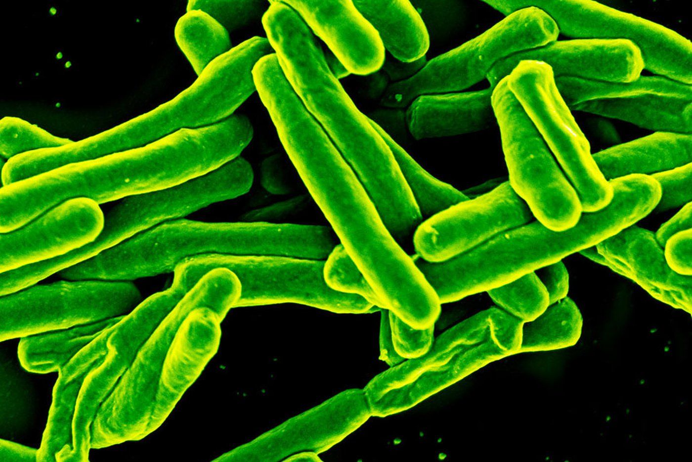 Can AI help solve PH's tuberculosis problem? | ABS-CBN News