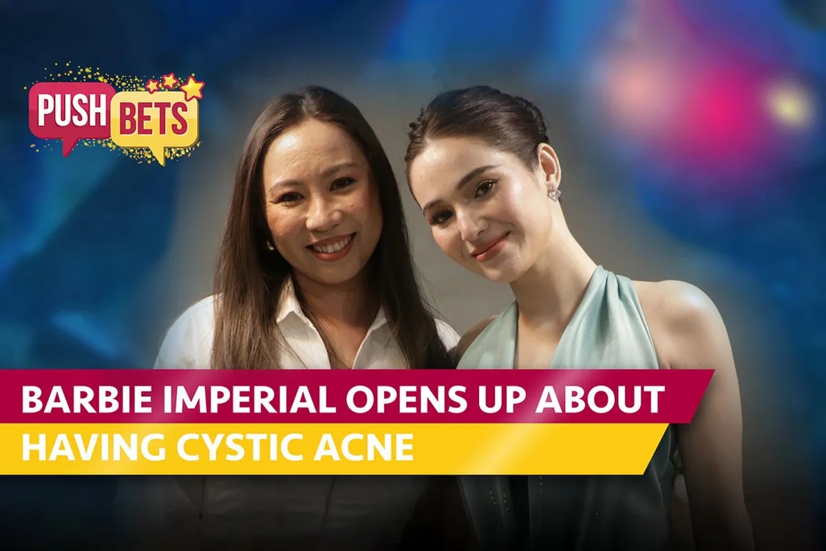Barbie Imperial opens up about having cystic acne | PUSH Bets | ABS-CBN ...