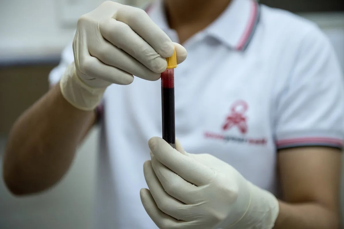 DOH assures enough antiretroviral drugs, testing kits amid concerns in ...
